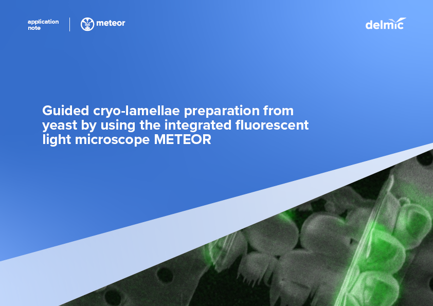 Focused ion beam sample preparation for cryo-electron tomography