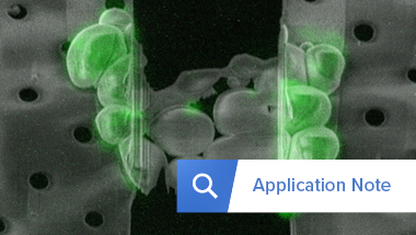 Subtomogram averaging in the cryo-ET workflow